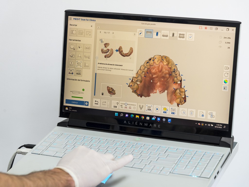 Odontología Digital Ziegler: Impresora 3D, scanner oral y fresadoras ...